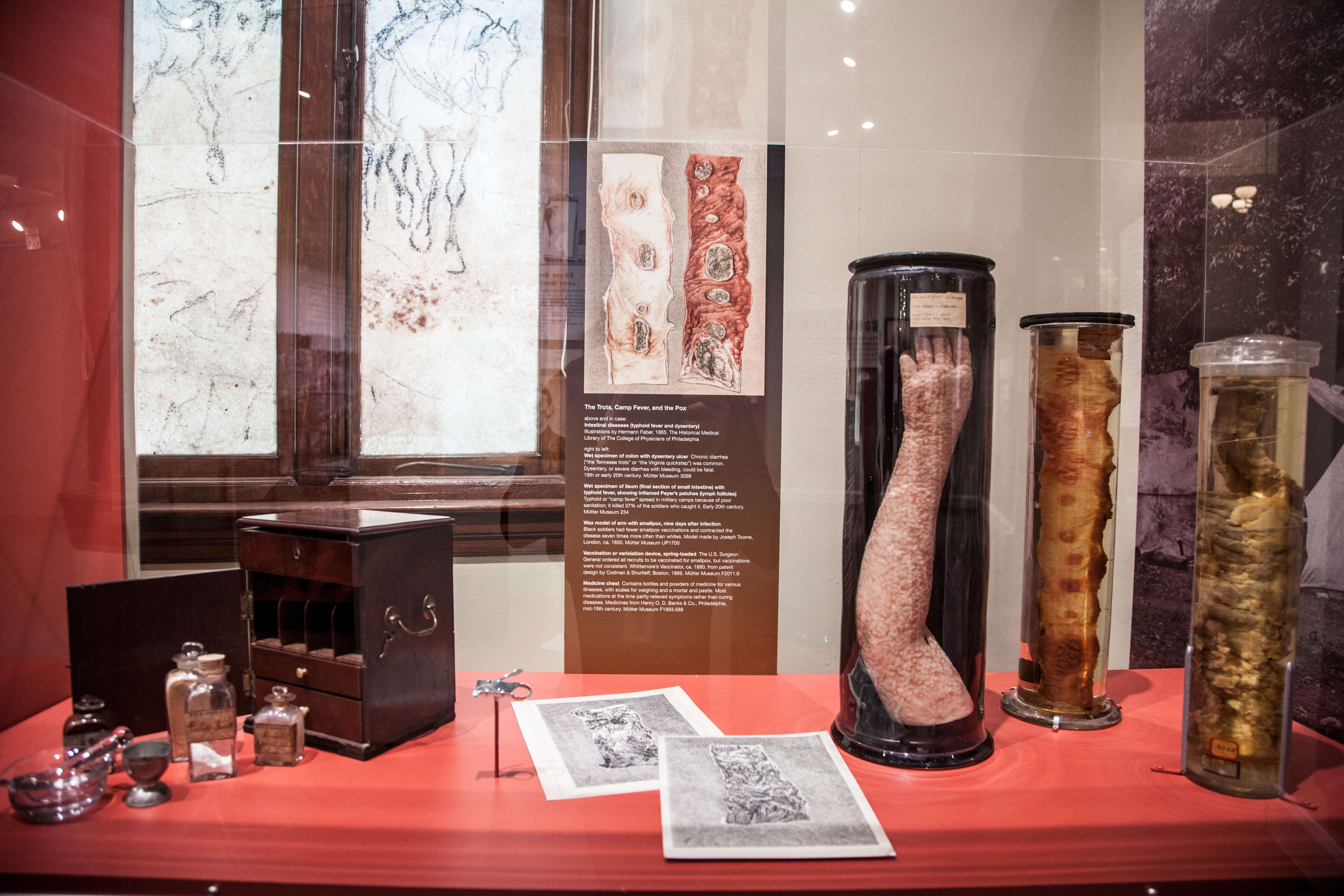 Mütter Museum - Fiction to Inspire Your Visit to Philadelphia's ...